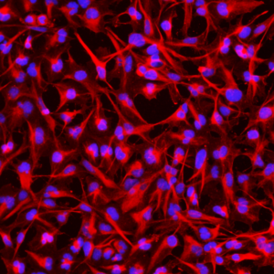 iPSC-derived Photoreceptor kit - CellSystems®