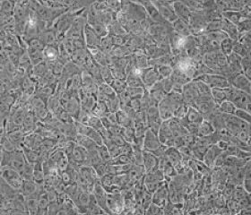 iPS Cells (iPSCs from Fibroblasts, Caucasian, Female, Age 47, Episomal ...