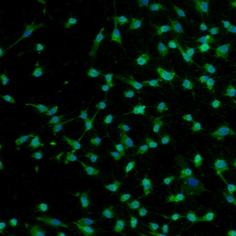 Human Adult Dermal Fibroblasts - HDFad - CellSystems®