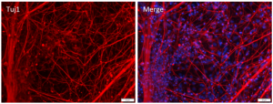 iPSC-derived Cortical Neuron Cell Kit (iPSCs from Fibroblasts, iPSC ...
