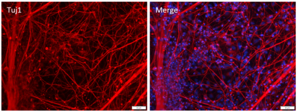 iPSC-derived Cortical Neuron Cell Kit (iPSCs from Fibroblasts, iPSC ...